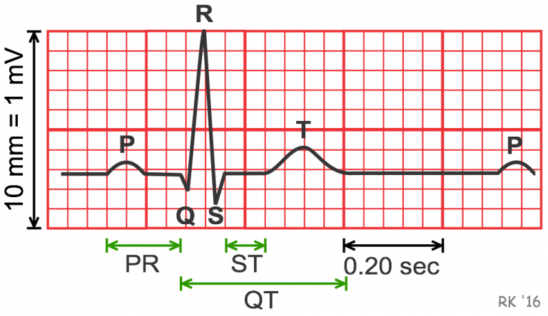 ACLS Cardiac EKG Arrhythmias and Treatments Cheat Sheet
