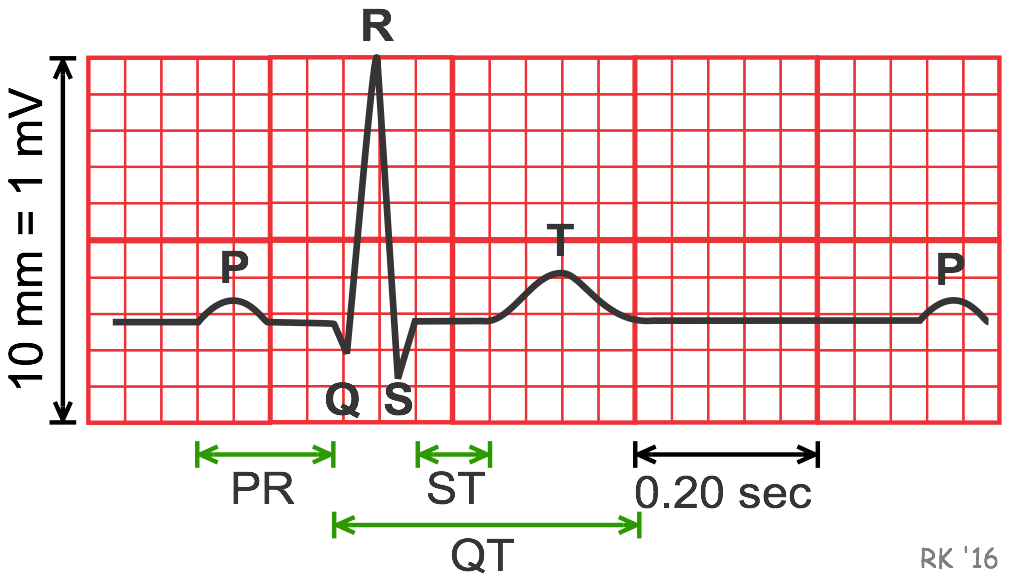 ACLS Cardiac EKG Arrhythmias and Treatments Cheat Sheet